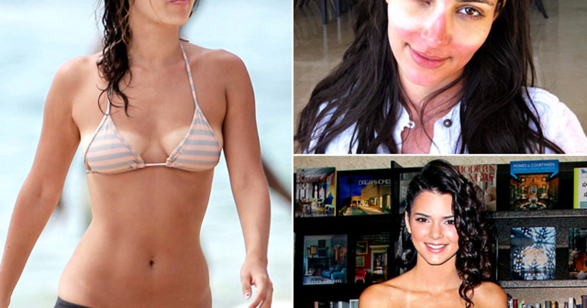 Celebrity Tan Lines And Sunburns Celebrity Tan Lines And Sunburns