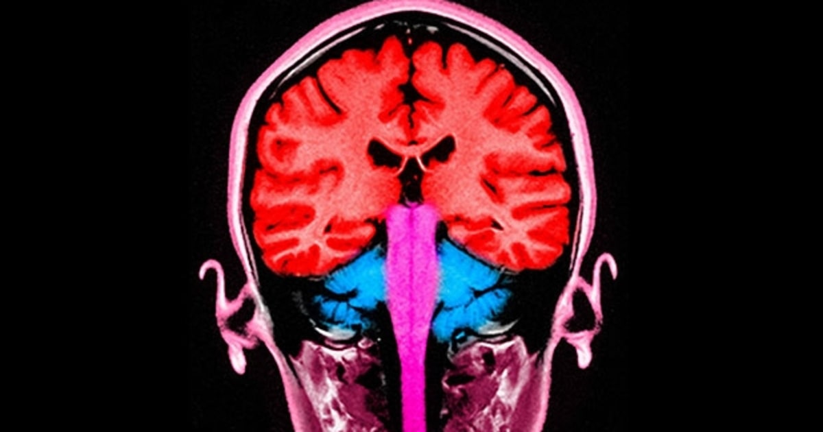 Brain Functioning | 9 Ways Orgasms May Benefit Your Health | Men's Journal